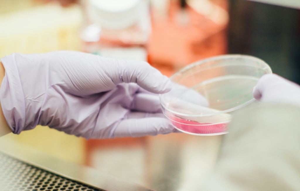 SAXS for Biostructural Research